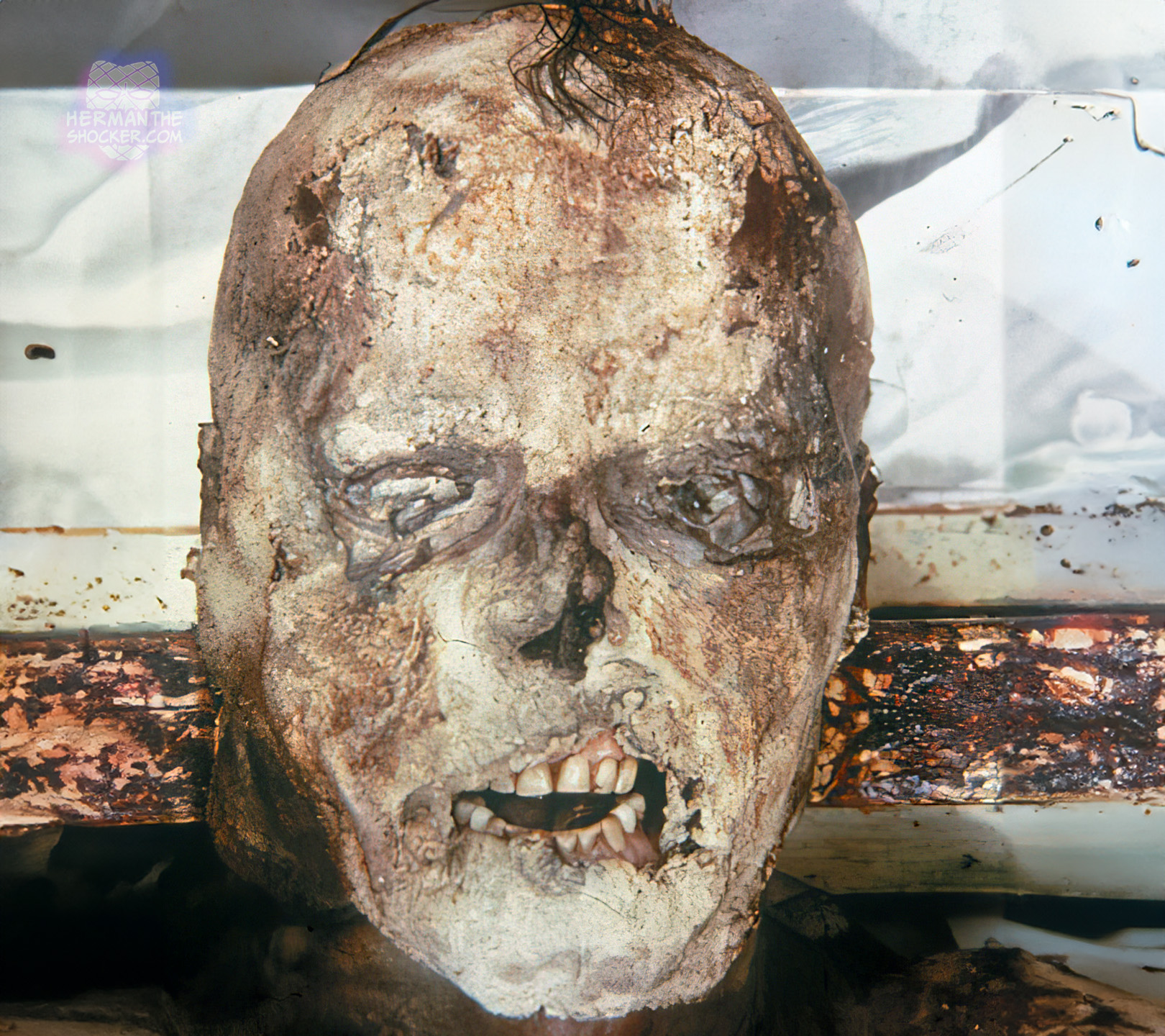 Adipocere formation on face - Herman The Shocker